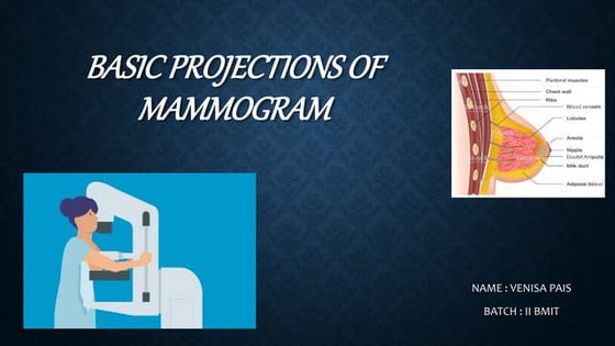 Mammography positioning technique for Lateral Views (LM/ML) | PPTX ...
