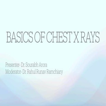 basics of chest xray with labelled diagram.pdf