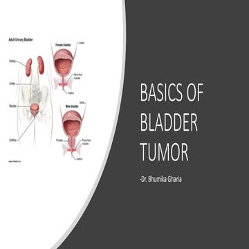 Basics of bladder tumors | PPTX | Cancer | Diseases and Conditions