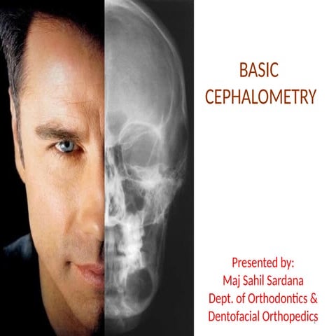 Pa ceph analysis | PPTX