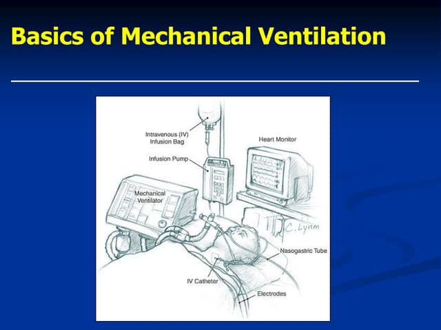 Ventilator Alarm Checklist | PDF