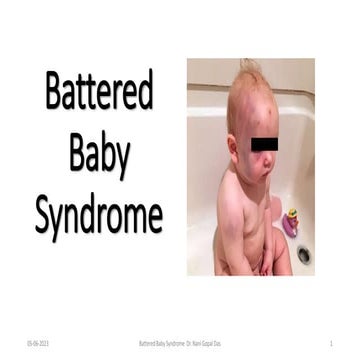 Battered Baby Syndrome.pptx
