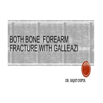 BBFA with galleazi.pptxlllllllllllllllll | PPTX