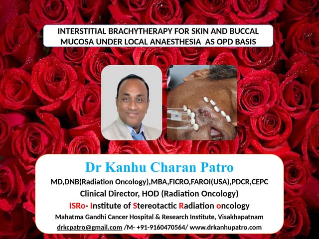 Normal Anatomy of Buccal mucosa and cancer | PPTX