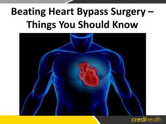 Coronary artery bypass grafting(stuti sah, bpt 4th yr) | PPT