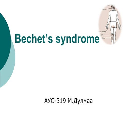 Bechet’s syndrome | PPT