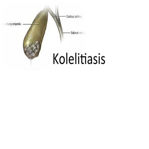 Bedah Digestif ---- SKD 2 - Cholelithiasis.ppt