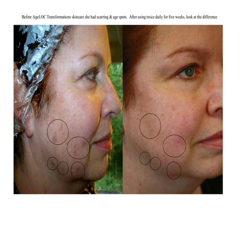 Half Face Before And After 2 | PDF