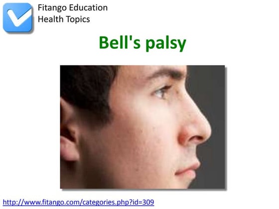 Bell's palsy | PPTX