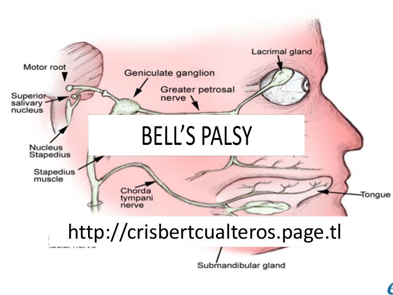 Bell’s palsy