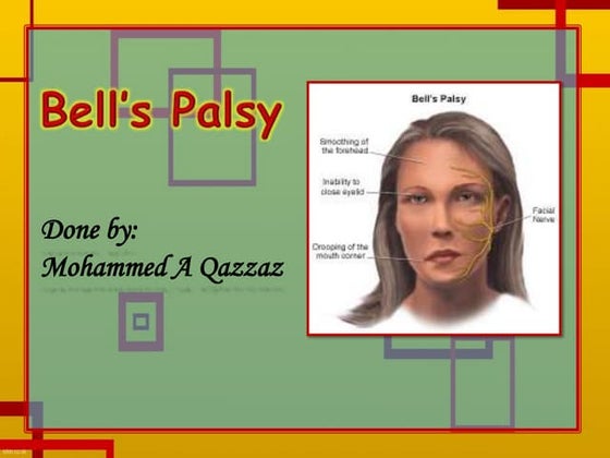Bell's palsy | PPT