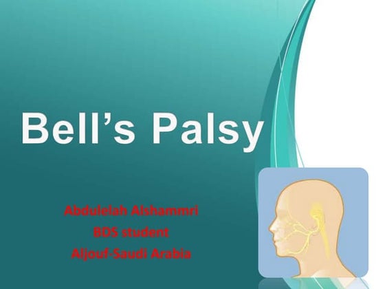 Bells Palsy | PDF