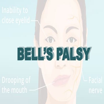 bells palsy.pptxNerve Injuries from Mandibular Third Molar Removal ...