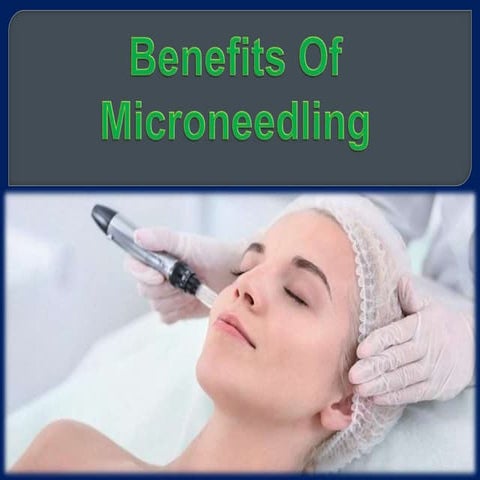 Benefits Of Microneedling.pptx