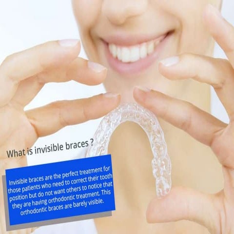 Benefits of invisible braces | PPTX