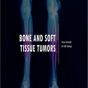 Benign bone tumor | PDF
