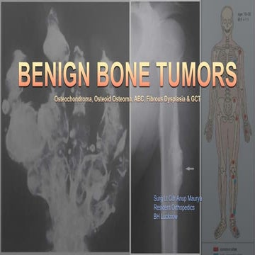 Benign bone tumors | PPT