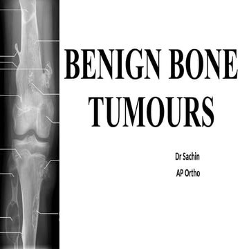 BENIGN BONE TUMOURS for orthopaedics.pptx