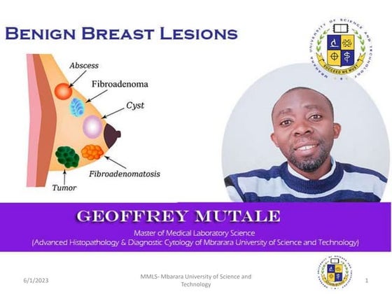 Endometrial Histology: Normal findings, artefacts and metaplasia | PPT