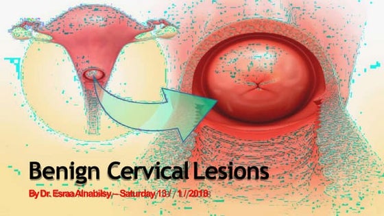 Benign Conditions of the Ovary (6).pptx