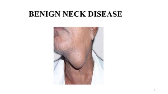 Hoarseness of voice by otorhinolaryngology.pptx