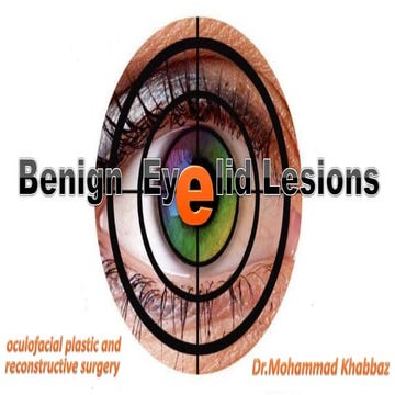 Benign eyelid tumors | PPTX | Skin and Dermatology | Diseases and ...