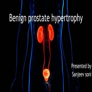 Benign prostate hypertrophy.pptx