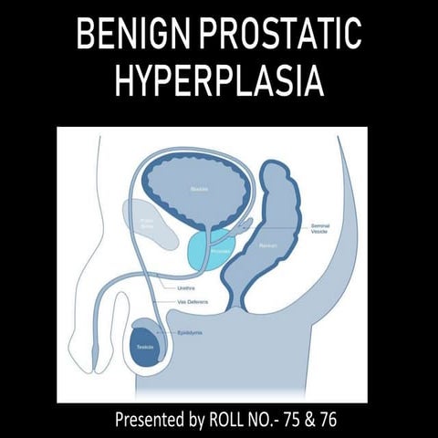 BENIGN PROSTATIC HYPERPLASIA.pptx