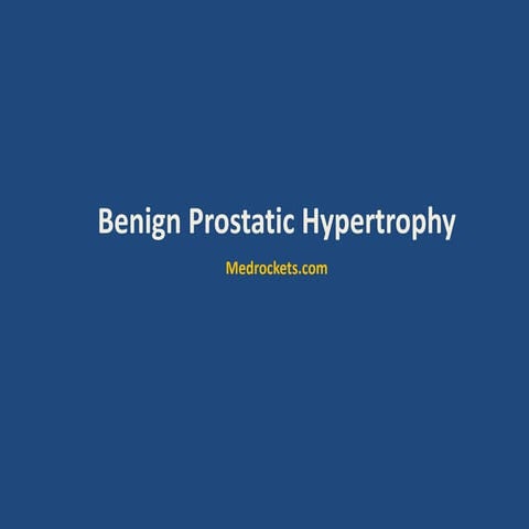 Benign prostatic hypertrophy | PPTX