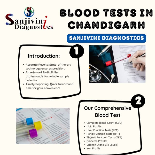 Best Blood Tests in chandigarh --sanjivinidiagnostics.pdf