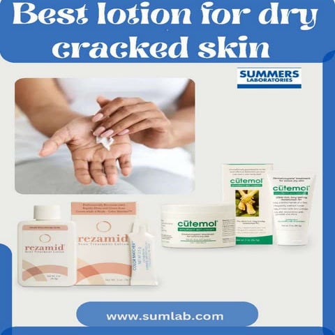 Which lotion is best for damaged or dry cracked skin? | PDF
