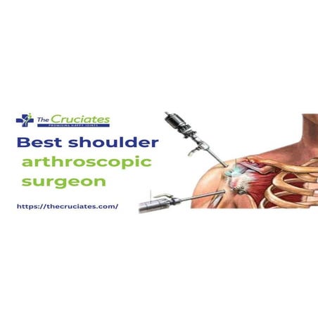 Best Spine Deformity Surgeon In India And Beyond Pdf