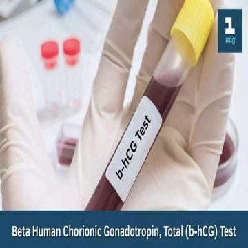 Beta hCG test | ODP