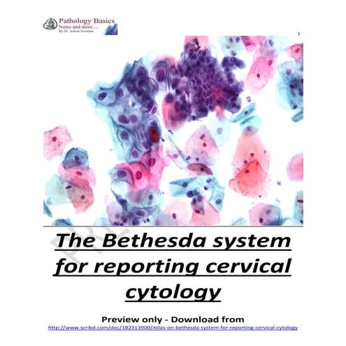 Bethesda system for cervix cytology | PPTX