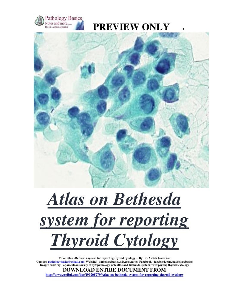 color atlas on bethesda system for reporting thyroid cytology