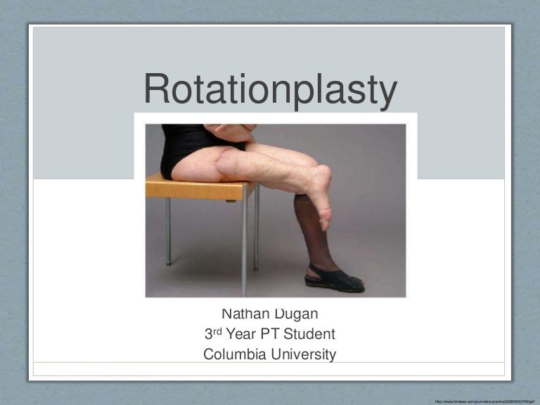Rotationplasty