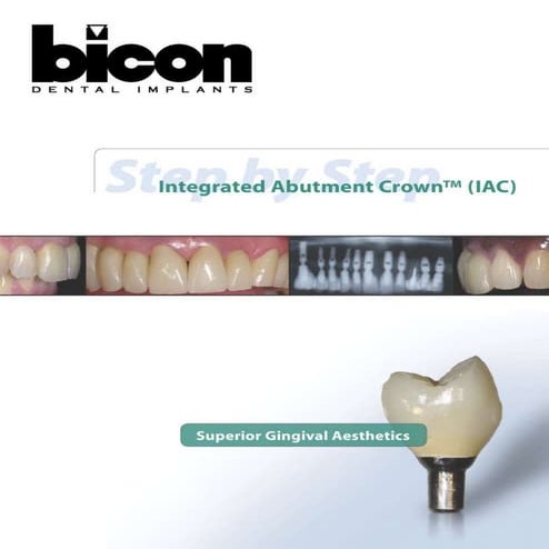 Bicon iac step_bystep | PDF
