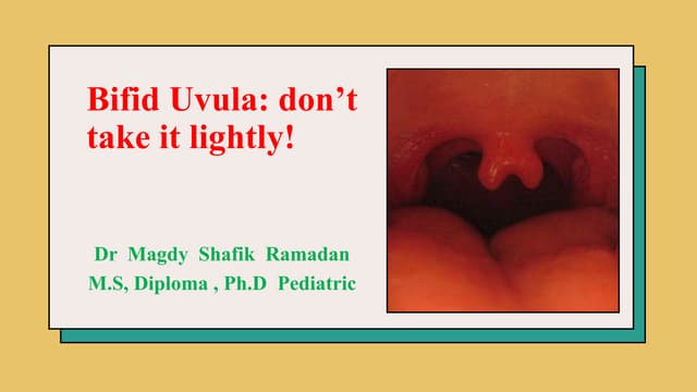 Tongue tieDiagnosis and mangement .pptx