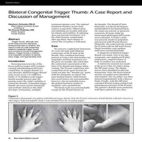 Bilateral Congenital Trigger Thumb | PDF