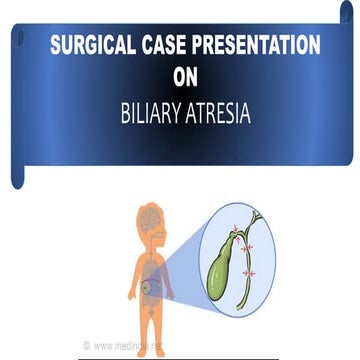 Biliary atresia | PPTX