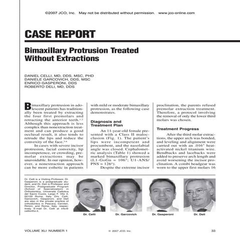 Bimaxillary protrusion treated without extraction | PDF