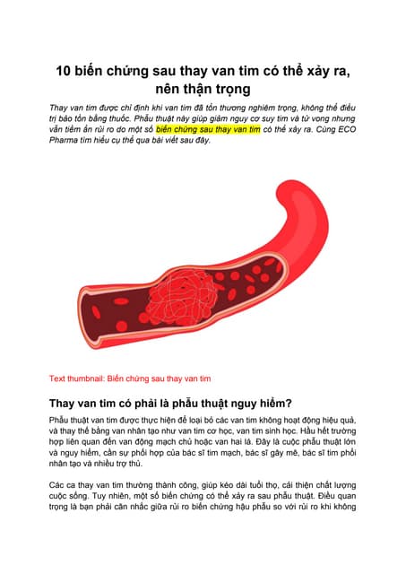 Harrison sulcus | PDF