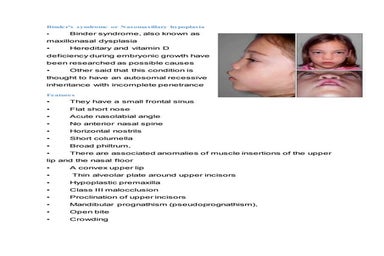 Robin Syndrome And Dwarfism