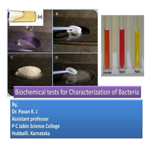 Gelatin Hydrolysis Test