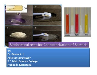 Biochemical test of bacteria | PPT