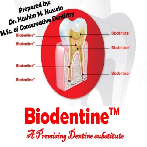 Access opening of molar teeth | PDF