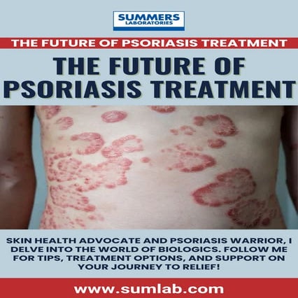 What types of biologics are available for treating psoriasis? | PDF