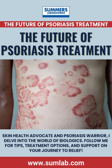 What are the treatment options for facial psoriasis? | PDF