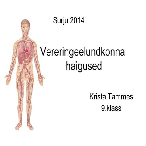 Vereringeelundkonna haigused | PPT