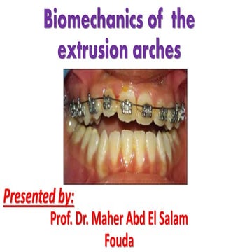 Elastics in Orthodontics-II | PPTX